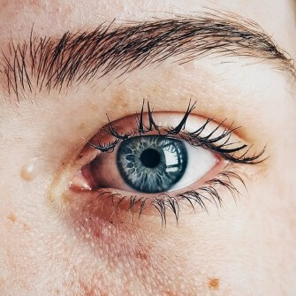 How to treat the skin around your eyes | Optical Express
