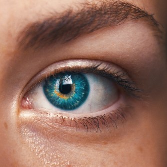 What is Eye Gound or Eye Gunk? | Optical Express